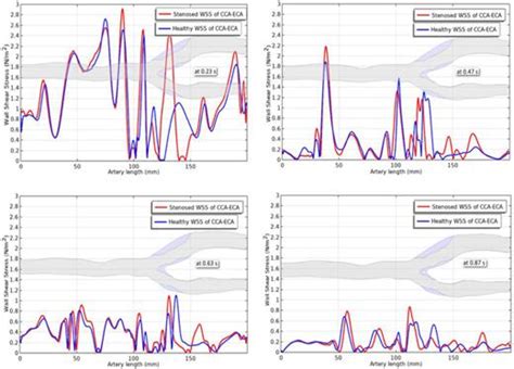 Unveiling Hemodynamic Pulsatile Flow Dynamics In Carotid Artery