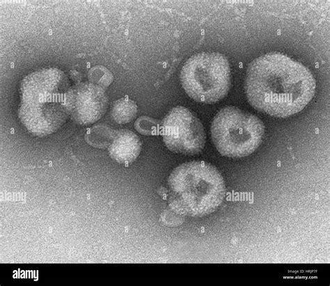 Lassa Virus Banque De Photographies Et Dimages à Haute Résolution Alamy