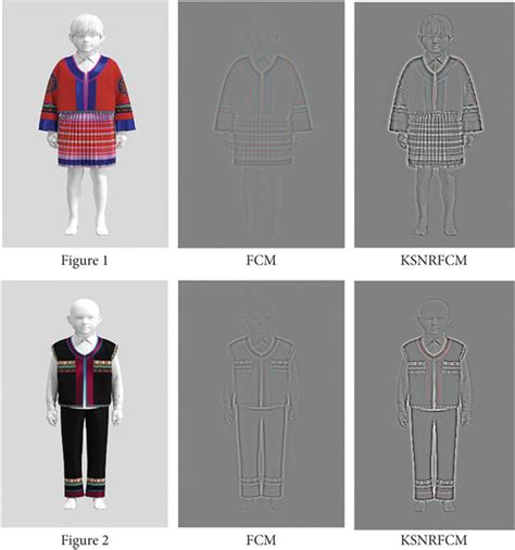 Comparison Of 3d Image Segmentation Effects Of Improved Fuzzy C Means