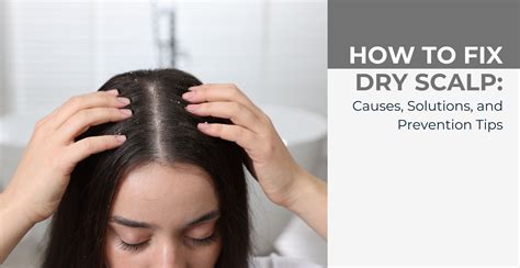 How To Fix Dry Scalp Causes Solutions And Prevention Clinikally