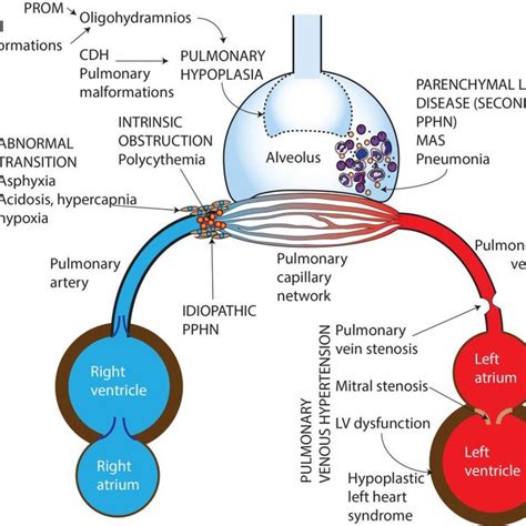 Differential Diagnosis Of Hypoxemia In Newborn Infants Download Table