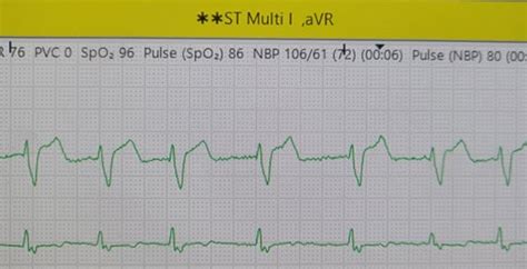 True St Elevation Rnursing