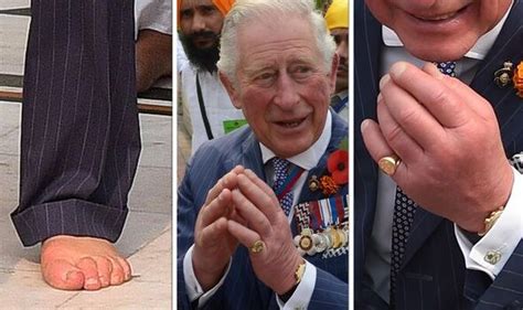 Prince Charles Health Swollen Hands And Feet Condition Laid Bare