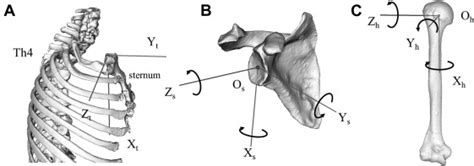 Three Dimensional Kinematic Features In Large And Massive Rotator Cuff Tears With Pseudoparesis