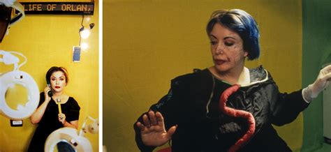 Orlan Before Surgery