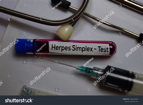 Herpes Simplex Test Blood Sample Top Stock Photo Edit Now 1656423694