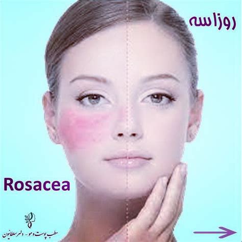 Seen Beauty Clinic 📷 کهن‌ترین عکس‌های دختران ایرانی عکس‌های آنتوان