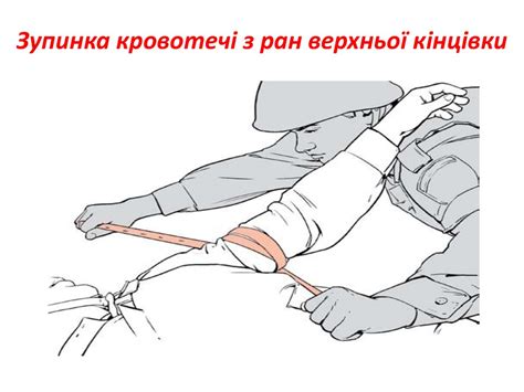 Загальні положення надання домедичної допомоги у секторі обстрілу презентация онлайн