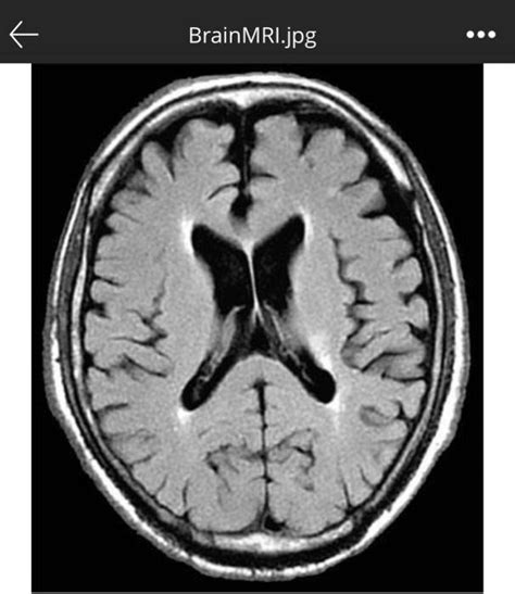 Solved Questions 1 What Is The Difference Between Binary