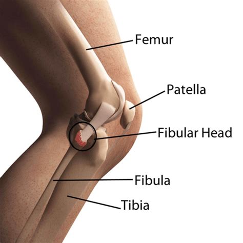 Fibular Head Joint Dysfunction What You Need To Know Cole Pain