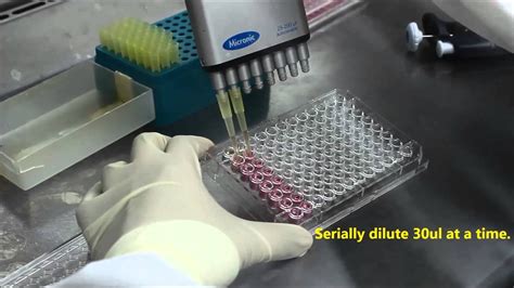 Tcid50 Preparation Youtube