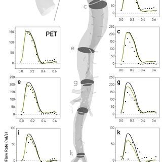 Flow Rate Waveforms From D D Min Across The Entire Aorta Compared Download Scientific Diagram