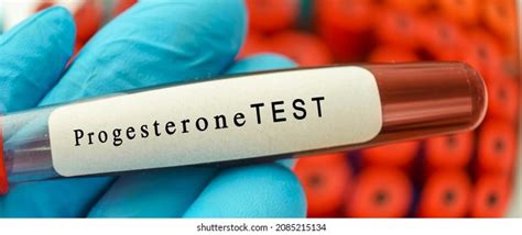 571 Progesterone Test Images Stock Photos Vectors Shutterstock