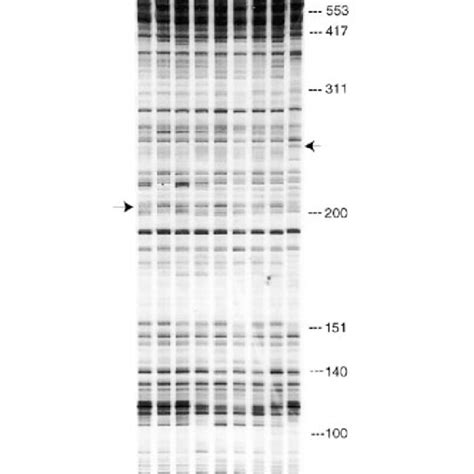Analysis Of Cdna Fragments Identified By Mrna Differential Display