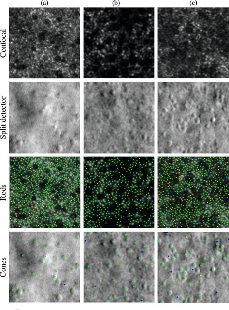 Figure 1 From Rac Cnn Multimodal Deep Learning Based Automatic Detection And Classification Of
