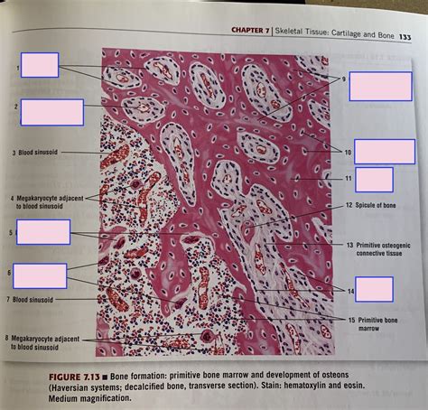 Identify Bone Components 1 Diagram Quizlet