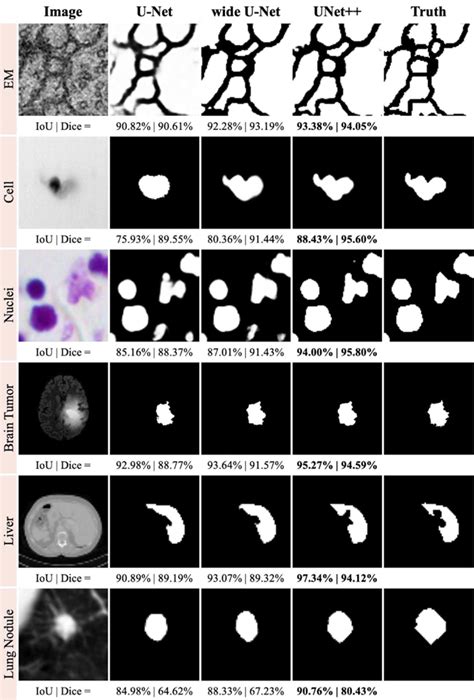 Unet Redesigning Skip Connections To Exploit Multiscale Features In