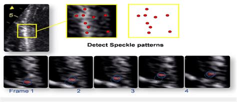 Figure Showing The Detection Of Speckle Pattern Of Consecutive Two Download Scientific Diagram