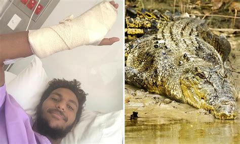 Saltwater Crocodile Attacks