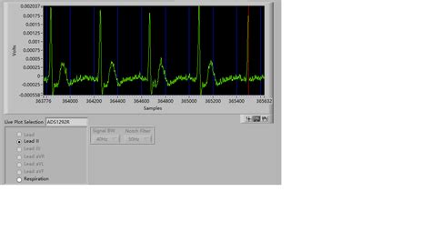 Ads1292recg Fe Ads1292r Ecg Fe Cant Read Correct Respiration Data Converters Forum Data