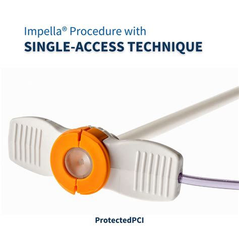 Protected Pci On Linkedin Download This Pdf To Read More About The