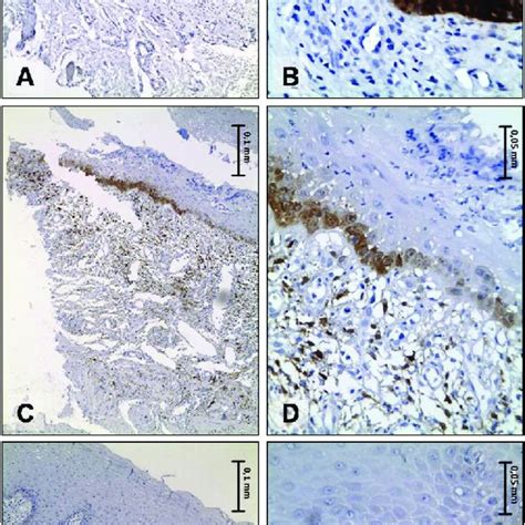 Staining Pattern Commonly Evidenced In The White A And B And Red C Download Scientific