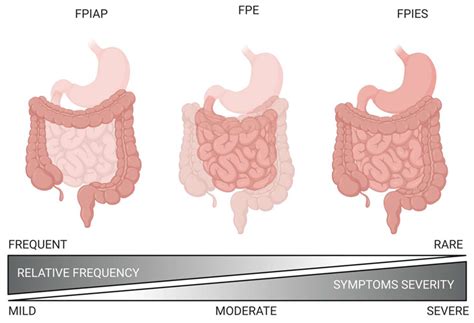 Gastrointestinal Organs Affected In The Different Non Ige Mediated