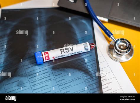 Blood Collection Tubes Respiratory Syncytial Virusrsv Test Positive
