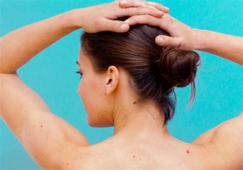 What You Need To Know About Melanoma Skin Cancer