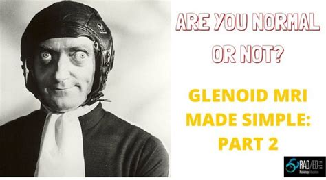 GLENOID LABRUM MRI SIMPLIFIED 2 Are You Normal Or Not Radedasia