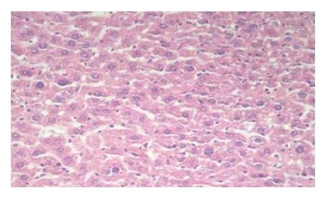 Histological Presentation Of H E Staining Of Liver Tissue Of The Mice Download Scientific