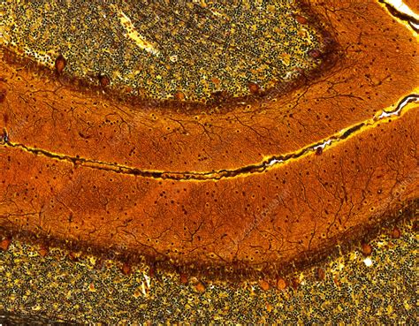 Brain Tissue Light Micrograph Stock Image C056 3813 Science Photo Library