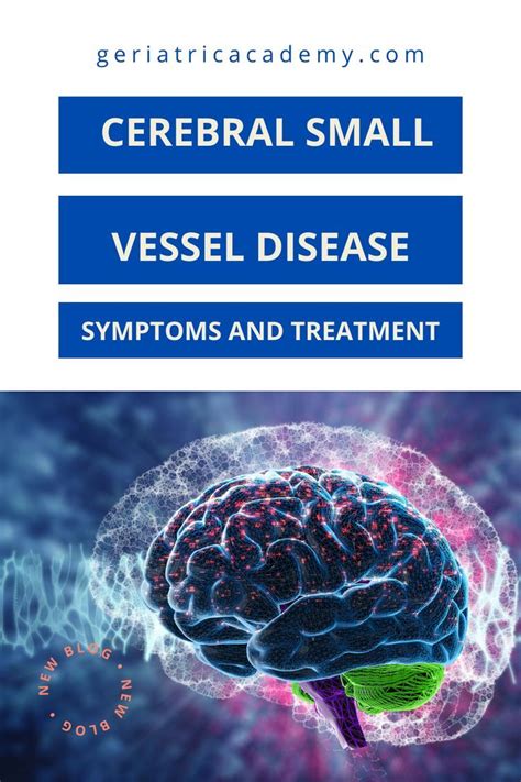 What Is Cerebral Small Vessel Disease Learn About The Symptoms And Treatments Artofit