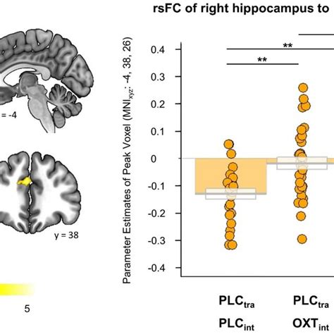 Treatment Effects On The Resting State Functional Connectivity Rsfc Download Scientific