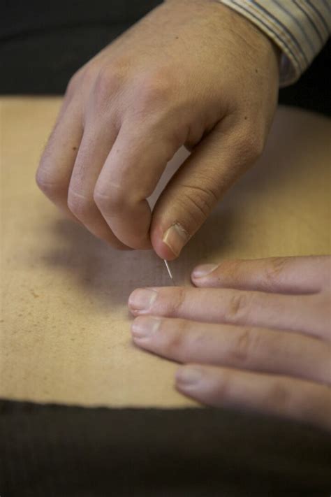 10 Things To Know About Acupuncture For Pelvic Pain Alban Acupuncture