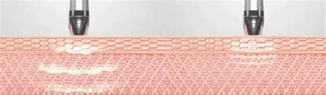 글로우엠 부스터소닉 내돈내산 효과 공구 할인 알아보기