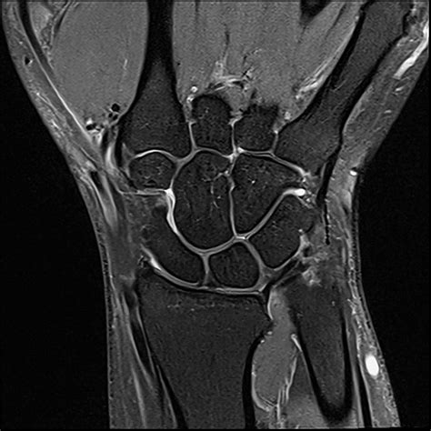 The Benefits Of Artificial Intelligence In Mri Are Not Solely Time Saving Jordan Sims