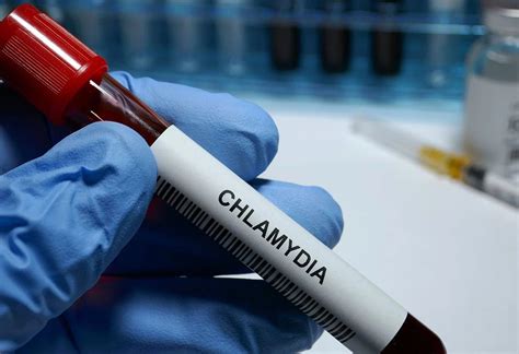Chlamydia Screening Std