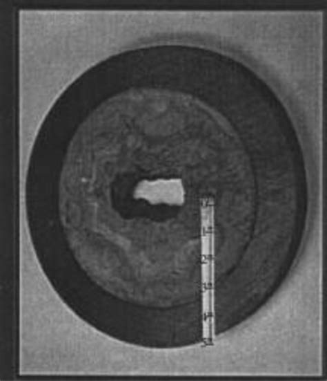 1 Example Of A Pipeline Blockage From Singh Et Al 2000 Download