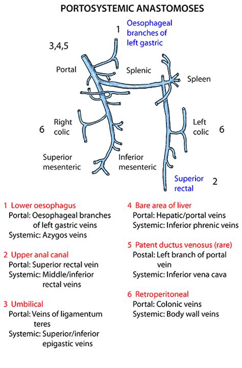 Portacaval Anastomosis Diagram