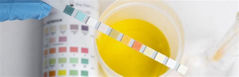Urinanalyse Ulti Med Products