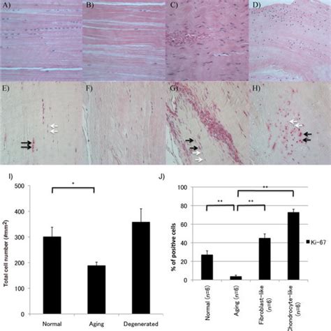 Sox9 Runx2 And Scleraxis Expression A D Sox9 E H Runx2 I L