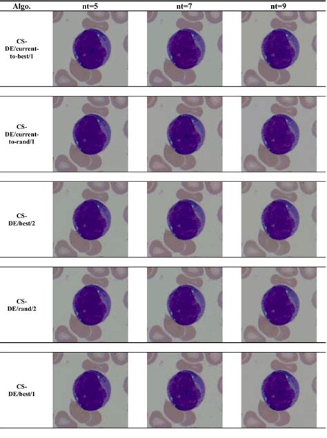 Segmented Outputs For Fig 1a Using The Seven Methods With 3 Different