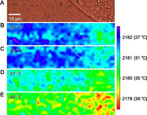 Temperature Mapping Of A Single Living Cell Under Different Culture