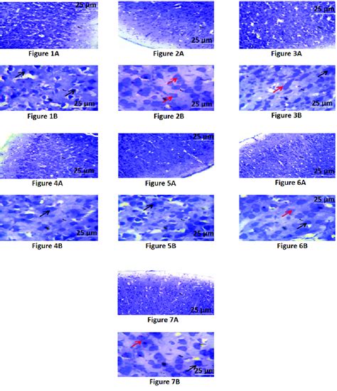 Section Of The Dorsolateral Prefrontal Cortex Of Rats Of Control Group Download Scientific
