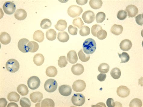 Reticulocyte Stain