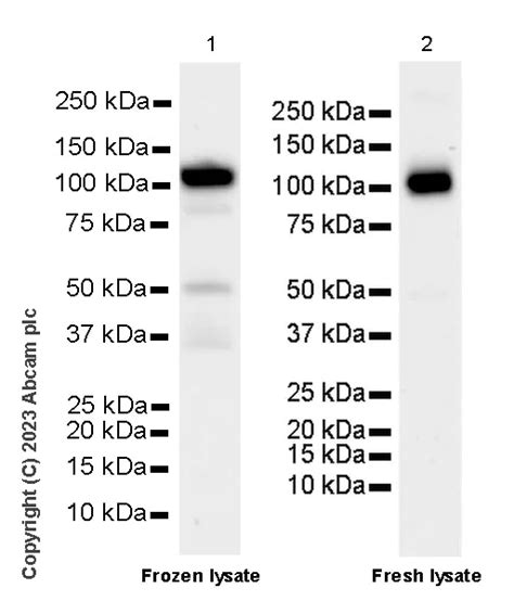 Anti Cbl Antibody [17 C Cbl] Ko Tested Ab309549 Abcam