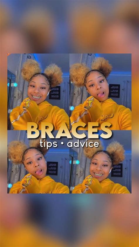 Braces Tips • Advice🪥 Braces Tips Cute Braces Braces Teeth Colors