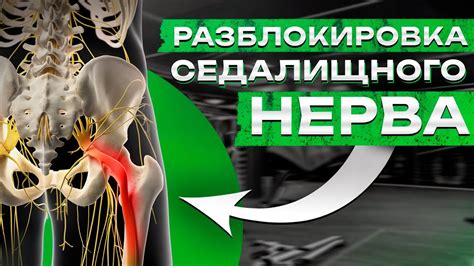 Как БЕЗ БОЛИ разблокировать СЕДАЛИЩНЫЙ НЕРВ Простые упражнения Youtube
