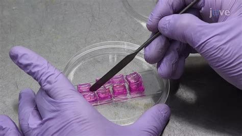 Modeling Ovarian Cancer Communication For Imaging Mass Spectrometry Analysis A Method To